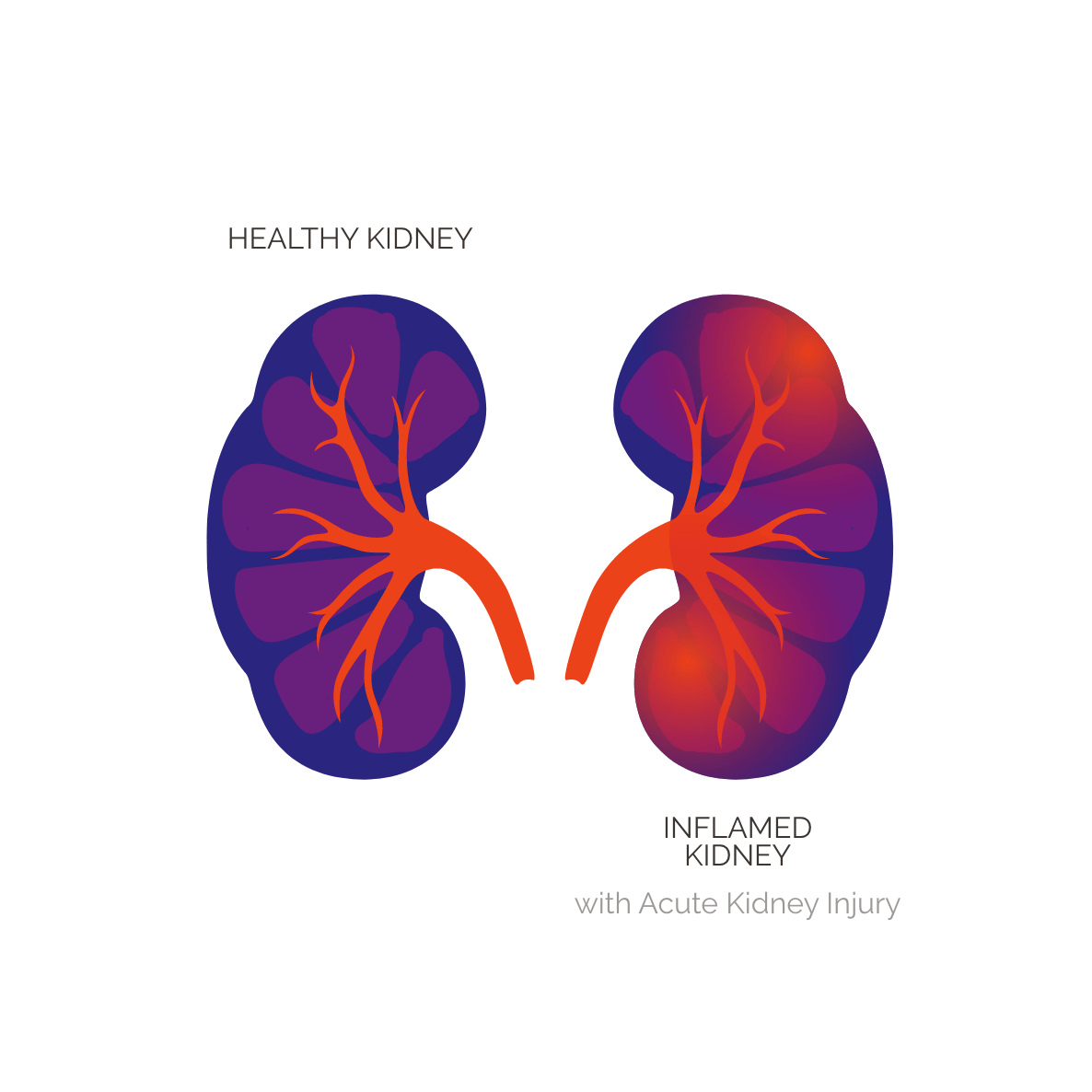 Kidney | CalciMedica