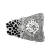 CalciMedica | CRAC Channel Inhibition for Inflammatory Diseases